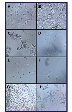 Protocolo para la citología vaginal directa de ratas de laboratorio ...